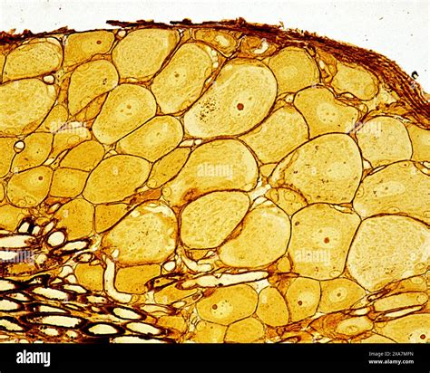 Light Micrograph Showing Connective Tissue Stained With A Silver Method