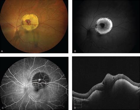 The Asia Pacific Journal Of Ophthalmology