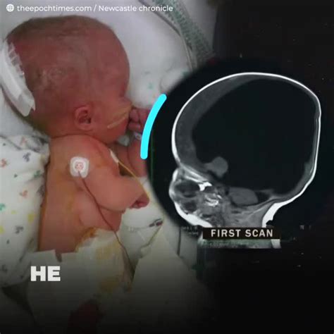 Jeanee Rose Andrewartha On Linkedin Defying The Odds 💪 Noah Wall Was