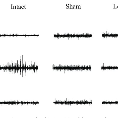 Representative Traces Of Three Second Multiunit Activity Were Obtained Download Scientific
