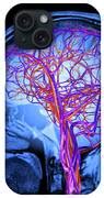 Vascular System Of The Brain Photograph By Alfred Pasieka Fine Art