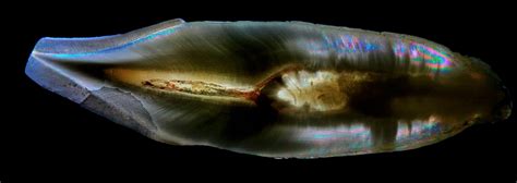 Interference Field Restoration Tooth Smileperfect