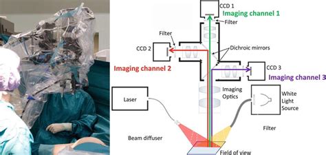 Intraoperative Optical Imaging Radiology Key
