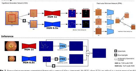 Figure 2 From Microaneurysms Segmentation And Diabetic Retinopathy Detection By Learning