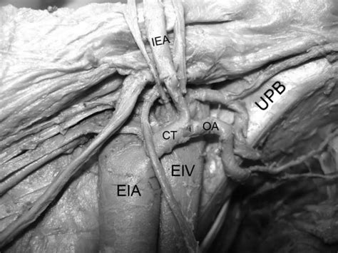 Dissection Of A Left Hemipelvis Anterior View The Common Trunk