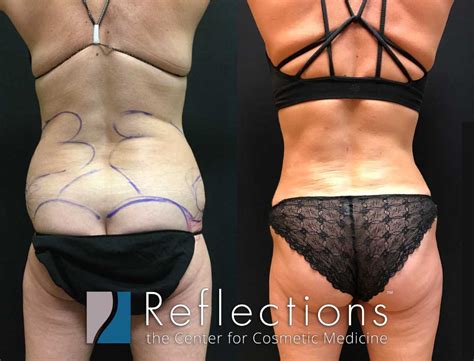 Bad Love Handles
