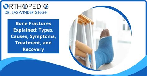 Bone Fractures Types Causes Symptoms And Treatment Dr Jaswinder Singh