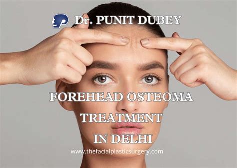Osteoma Forehead Treatment In Delhi