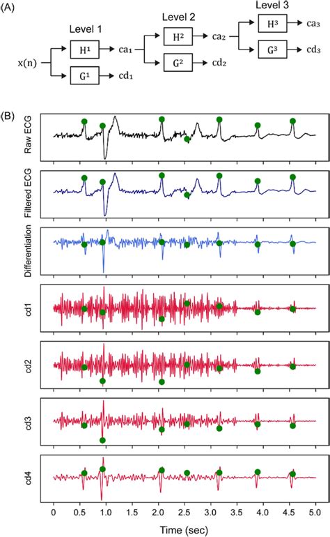 Robust R Peak Detection In An Electrocardiogram With Stationary Wavelet
