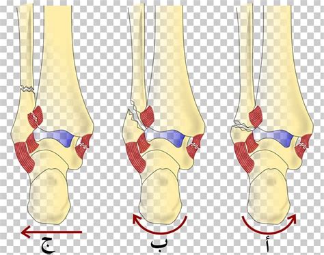 Danisweber Classification Ankle Fracture Lauge Hansen Classification Bone Fracture Malleolus