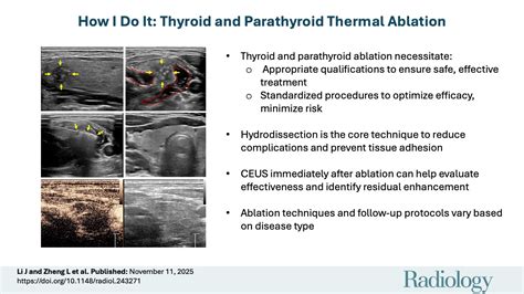How I Do It Thyroid And Parathyroid Thermal Ablation Radiology