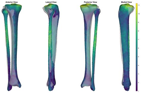 Geometric Variation Of The Human Tibia Fibula A Public Dataset Of Tibia Fibula Surface Meshes