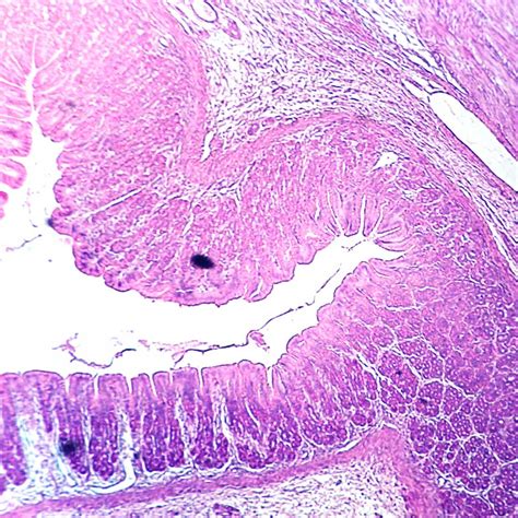 Stomach Microscope Slide