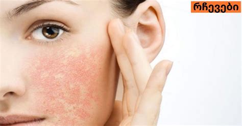 მგრძნობიარე კანის მოვლა