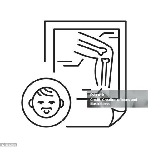 소아 정형 외과 블랙 라인 아이콘입니다 골절과 염좌 어린이의 검사와 치료 웹 페이지 모바일 앱 프로모션에 대한 픽토그램 Ui Ux Gui 디자인 요소 0명에 대한 스톡 벡터