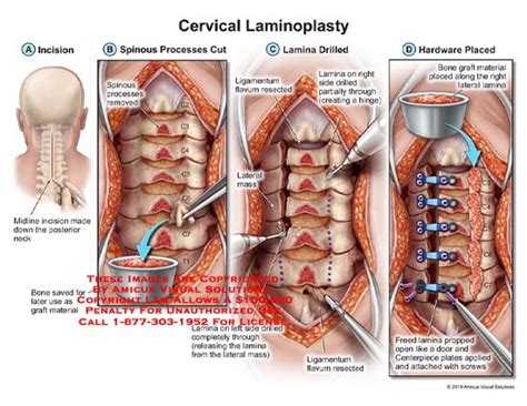 Medical Exhibits Demonstrative Aids Illustrations And Models