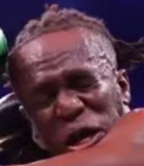 What Happened To Bros Face R Ksi