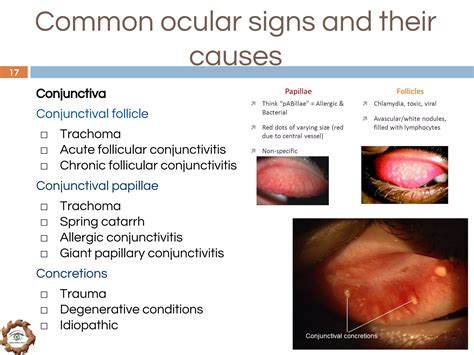 Protocol For Differential Diagnosis Of Common Ocular Diseases Pdf