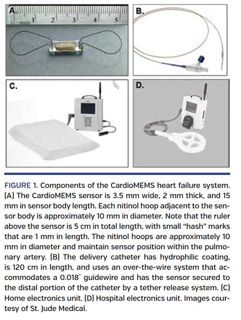 The Cardiomems Heart Failure Sensor A Procedural Guide For Implanting
