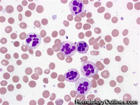 Hematologyoutlines Atlas