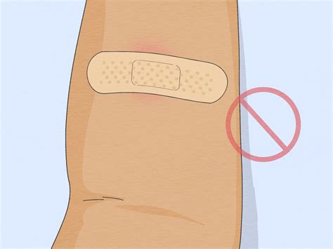 วิธีการ ตรวจคัดกรองวัณโรคอย่างถูกวิธี พร้อมรูปภาพ Wikihow