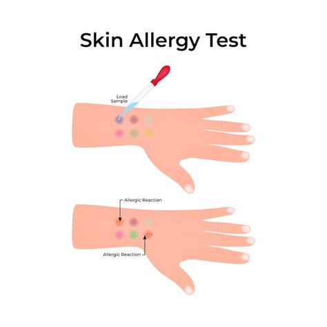 Drug Allergy Testing Vectors Download Free High Quality Vectors From Freepik Freepik