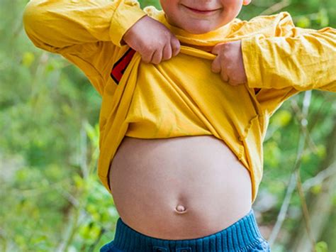 Outie Belly Button Surgery Caption Simple