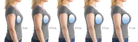 F Cup Breast Implants Best Hospital For Breast Augmentation Surgery In