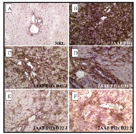 Thy 1 Staining Of Srrna Treated Tissue A Normal Rat Liver B