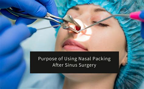 Purpose Of Using Nasal Packing After Sinus Surgery Mbi