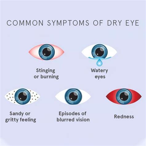 Dry Eye Syndrome — Eye Academy