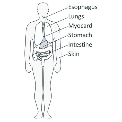 Organs Commonly Affected By Diffuse Cutaneous Ssc Download