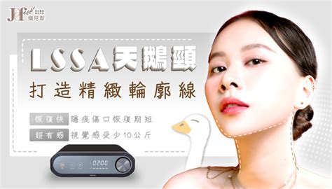 「超音波溶脂」— Lssa天鵝頸手術消除雙下巴 傑尼斯醫美
