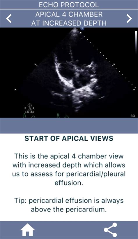 Learn The Full Tte Echo Ultrasound Protocol Demo For Android Download