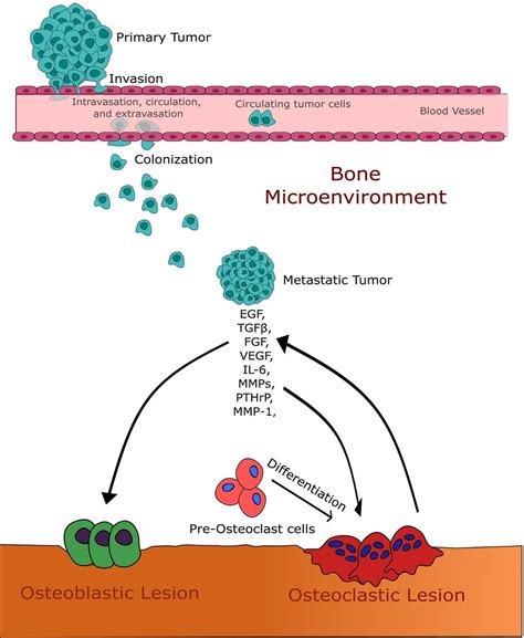 From Tumor To Bone Growth Factor Receptors As Key Players In Cancer