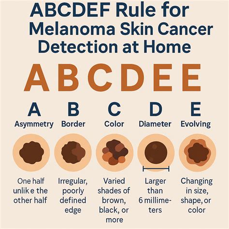 How To Check For Skin Cancer At Home Easy Self Exam Guide