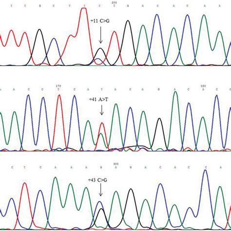 Direct Dna Sequencing Analysis Of The B Globin Gene Showing The 3utr