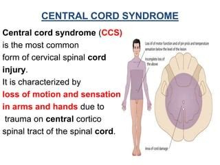 Spinal Cord Injuries Pptx