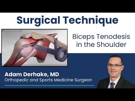 Is Biceps Tenodesis Included In Total Shoulder Arthroplasty