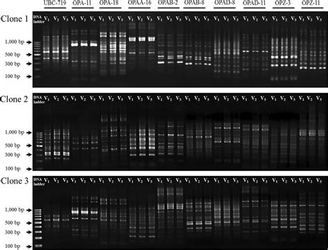 Gel Electrophoresis Of Random Amplification Of Polymorphic Dna Rapd Download Scientific