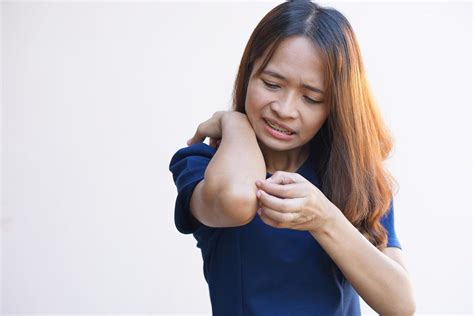 Asian woman having itchy skin 17521581 Stock Photo at Vecteezy