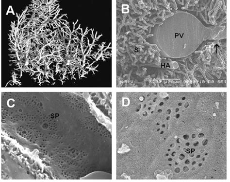 The Hepatic Microcirculation And Sinusoids A Threedimensional
