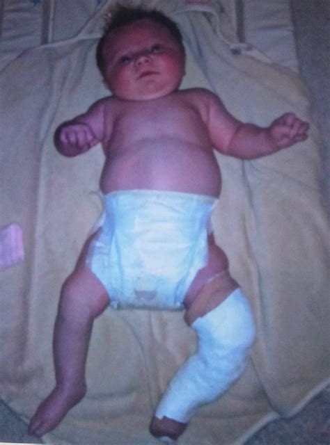 Adeles Story Adele Was Born Steps Charity Worldwide