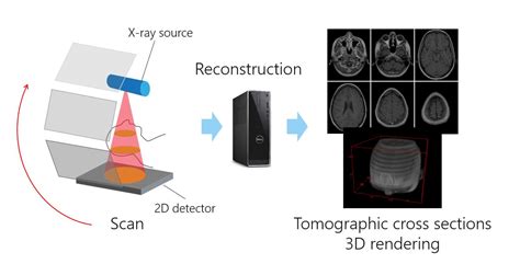 X Ray Computed Tomography A Brief Introduction