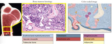Hemolymphatic Pathology Flashcards Quizlet
