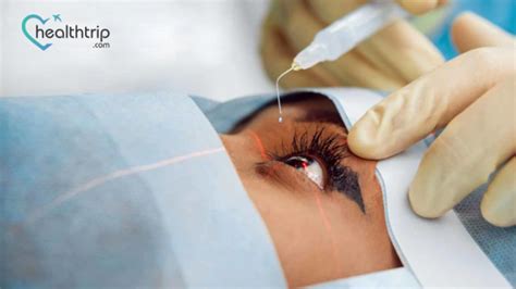 Cataract Surgery Timeline In India Procedure And Timeline Healthtrip