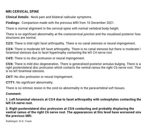 Neck Arthritis Rthritis