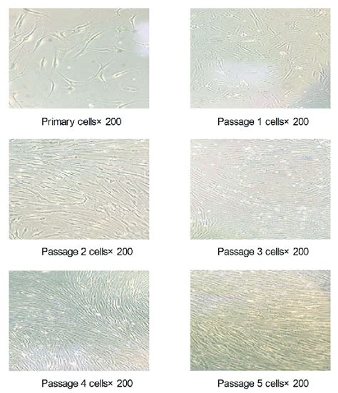 Morphological Observation Of Ra Synovial Cells The Synovial Tissues