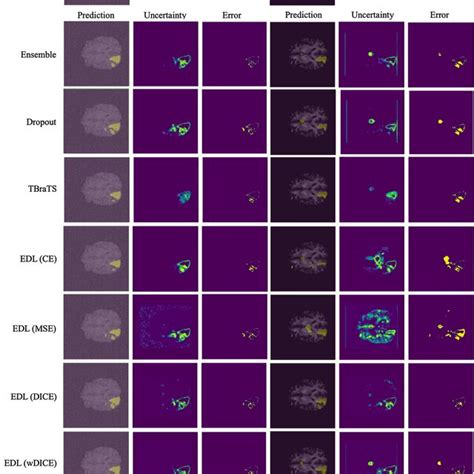 Representative Visual Segmentation Results Of The Proposed Region Based Download Scientific