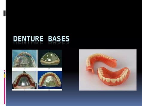 Denture Bases Pptx
